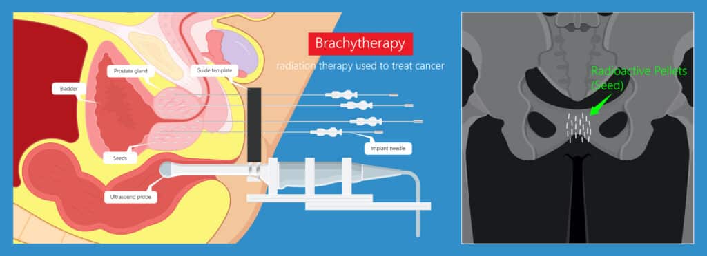 Projects Gallery - IBC Advanced Technologies